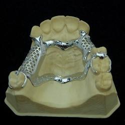 Dolomite Dental - CAD Chrome Partial